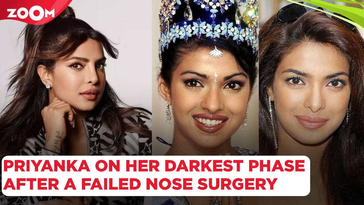 Priyanka Chopra REVEALS about her darkest phase in life after a failed nose surgery | Bollywood ...