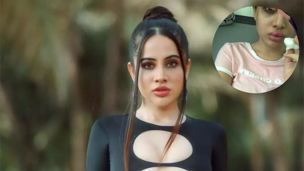 Urfi Javed Says She Is Getting Lip Fillers Since 18. BUT There Is A ...